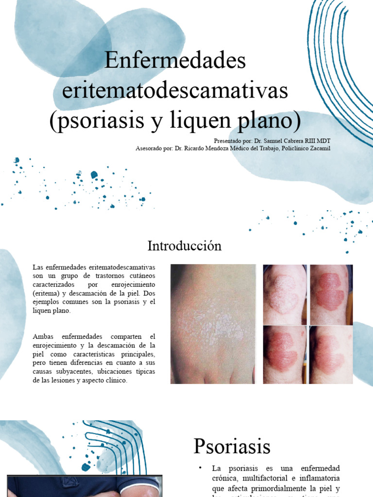 Enfermedades Eritematodescamativas | PDF | Psoriasis | Inflamación