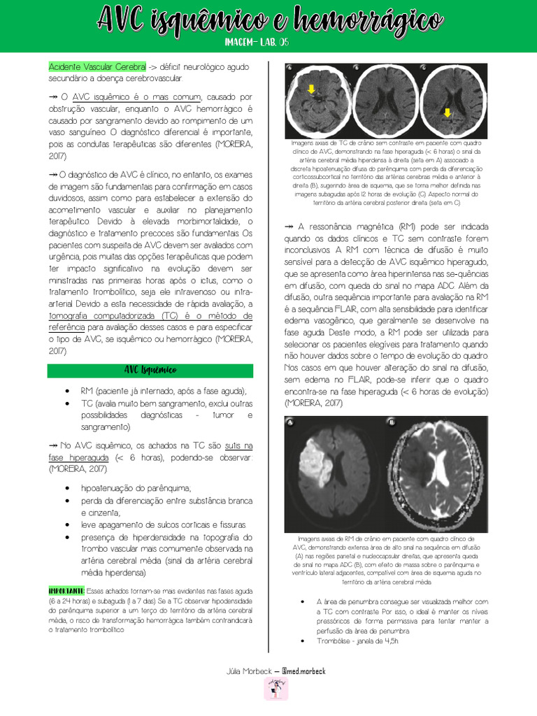 Imagem Lab 05 - Avc Isquêmico e Hemorrágico | PDF | AVC | Doenças e ...