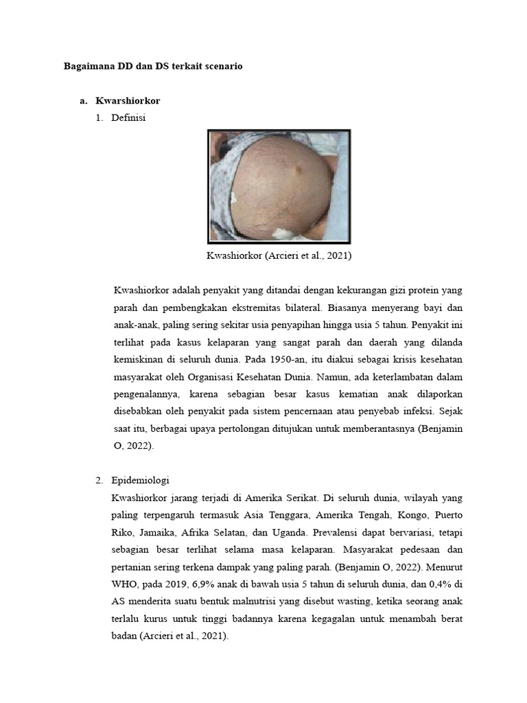 DD Ds Marasmus Dan Kwashiorkor | PDF