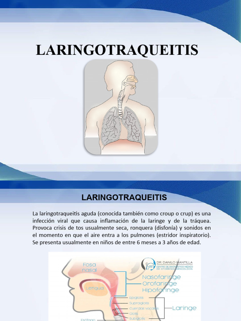 Laringotraqueitis | PDF | Medicina | Epidemiología