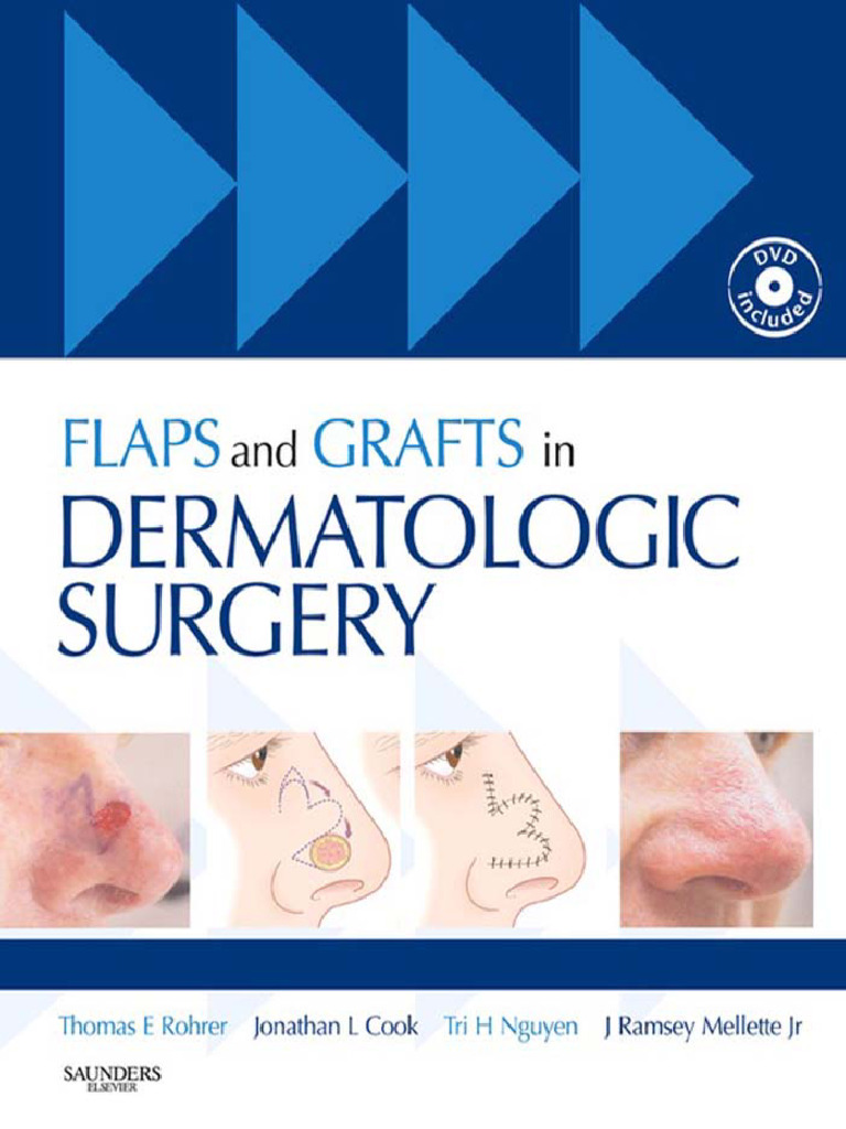 Flaps and Grafts in Dermatologic Surgery 1st Ed (2007) | PDF | License ...