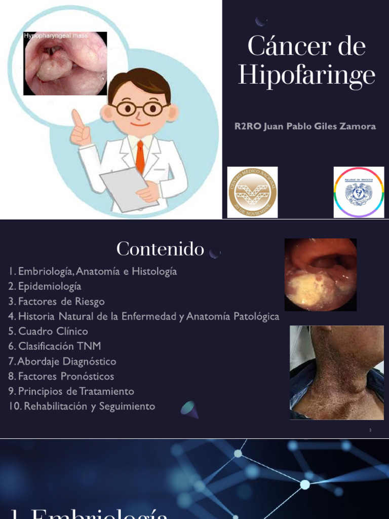 Cáncer de Hipofaringe | PDF | Cáncer | Metástasis