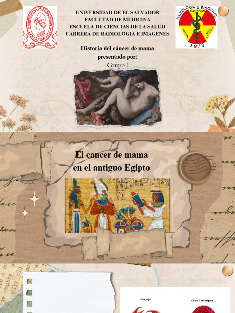 G1 HISTORIA DEL CÁNCER DE MAMA ppt | PDF | Mamografía | Medicina CLINICA