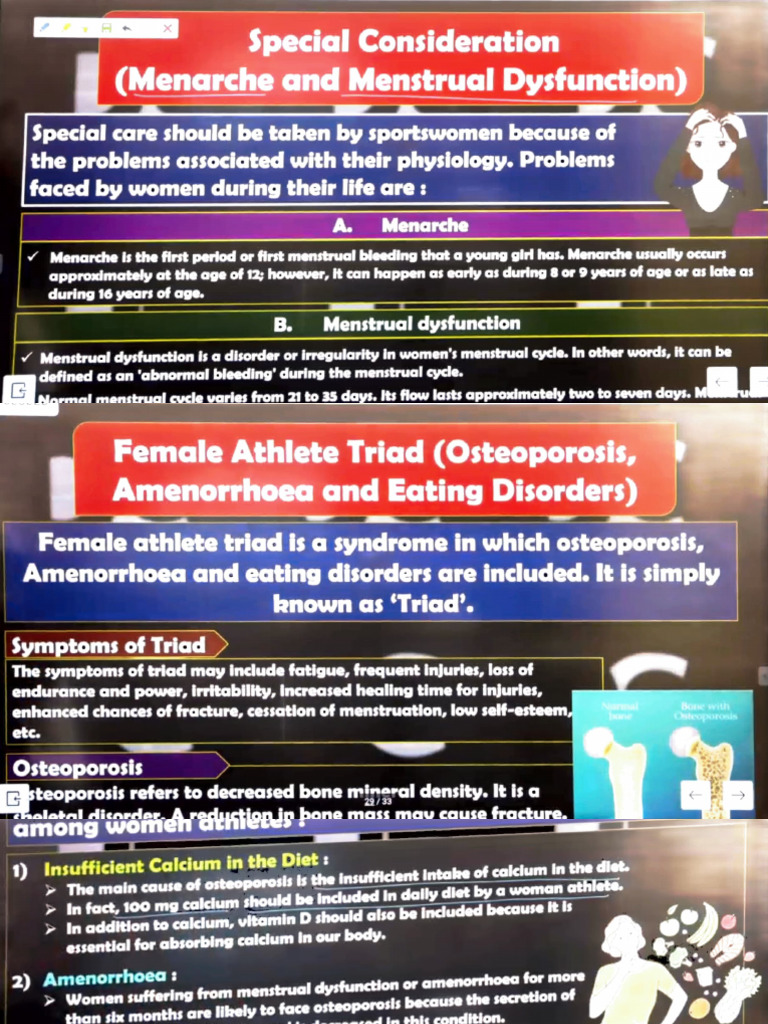 Female Athletes Triad | PDF