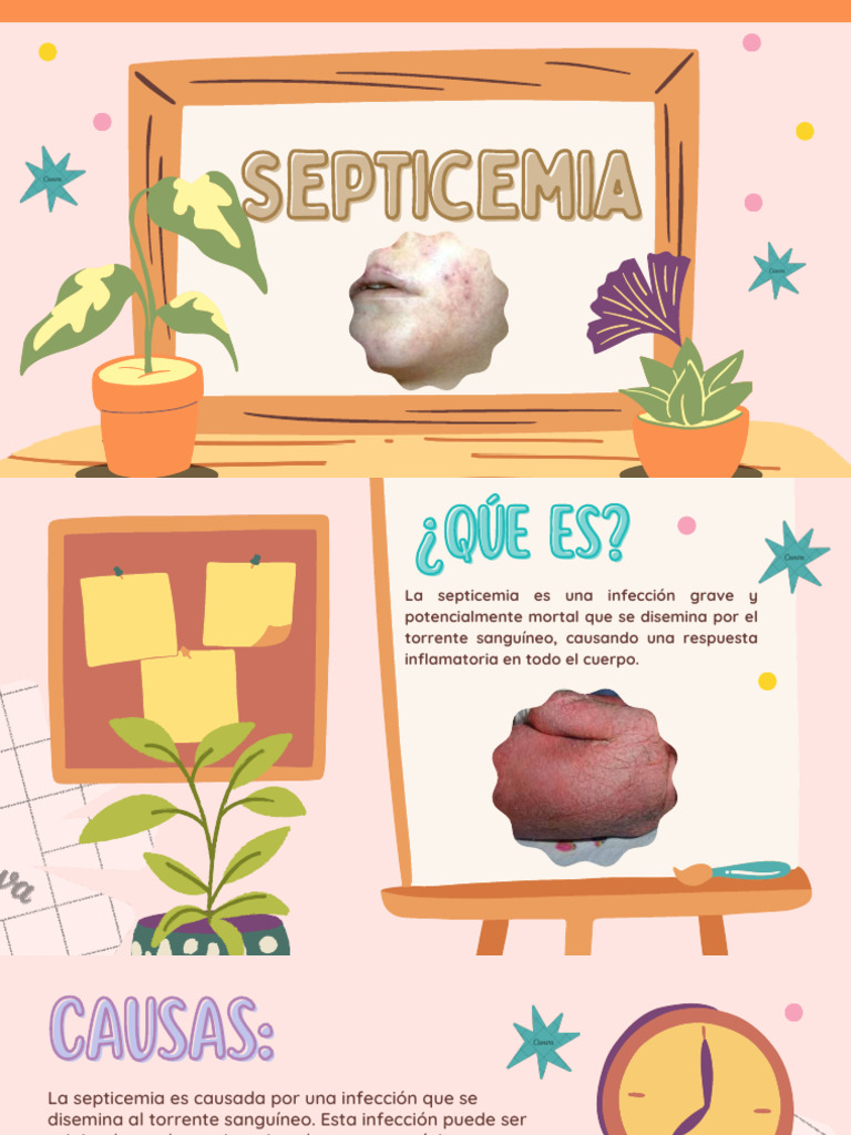 Septi | PDF | Septicemia | VIH