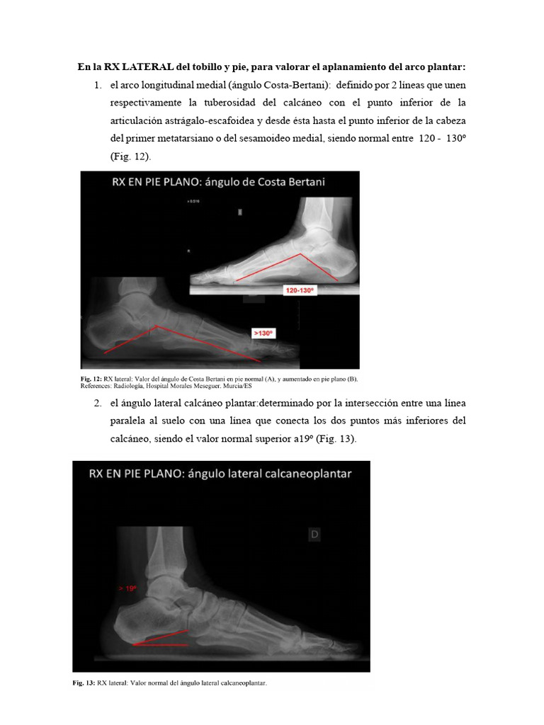 Evaluación Radiográfica del Arco Plantar | PDF