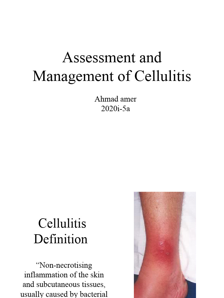 Cellulitis | PDF | Clinical Medicine | Medical Specialties