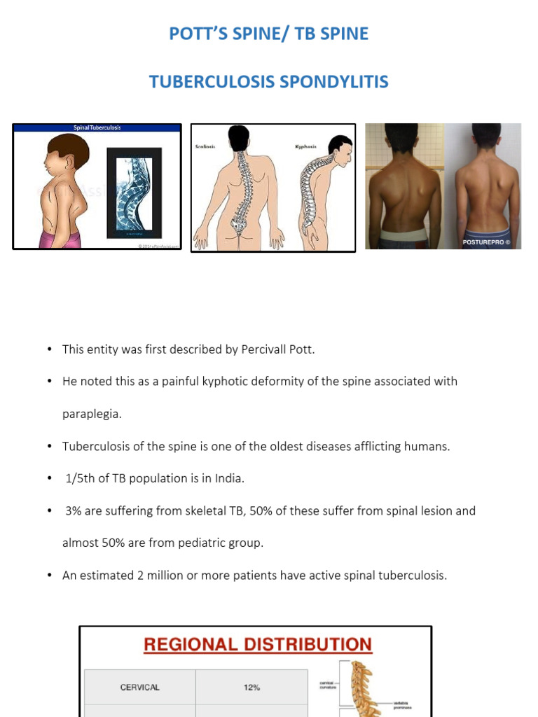 Pott S Spine | PDF | Tuberculosis | Vertebral Column