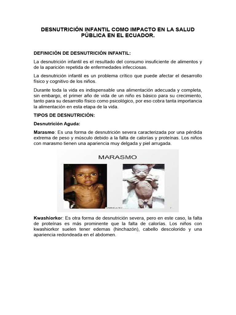Desnutrición Infantil Como Impacto En La Salud Pública En El Ecuador
