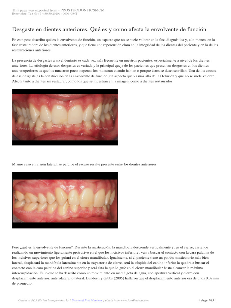 00 Desgaste Dientes Anteriores | PDF | Diente | Boca
