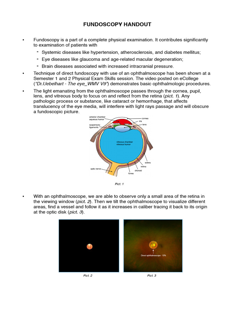 Fundoscopy Handout | Download Free PDF | Retina | Ophthalmology