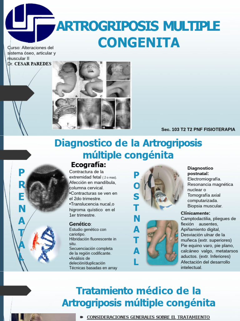 Artrogriposis Multiple Congenita Presentacion | Descargar gratis PDF ...