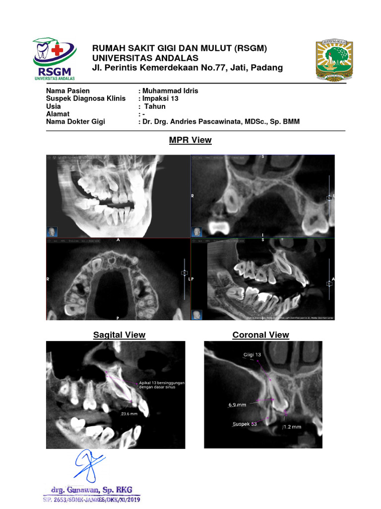 Muhammad Idris - Impaksi 13 - Lembar Gambar CBCT | PDF