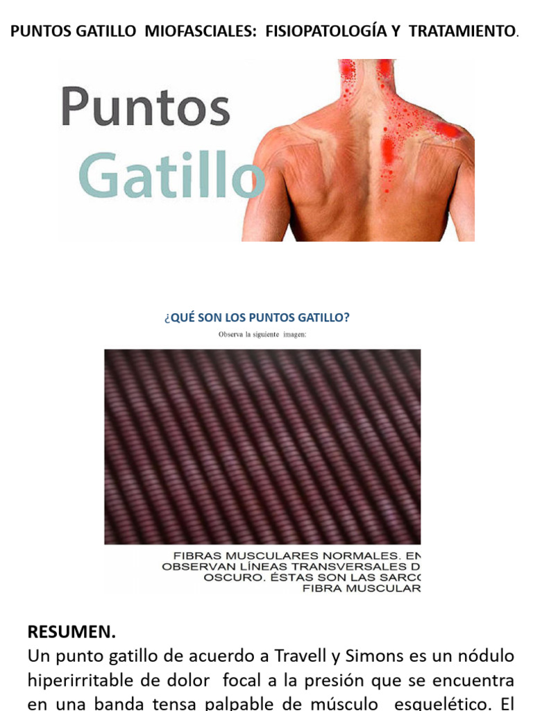 1.puntos gatillo y puncion seca | Descargar gratis PDF | Músculo | Punto gatillo miofascial