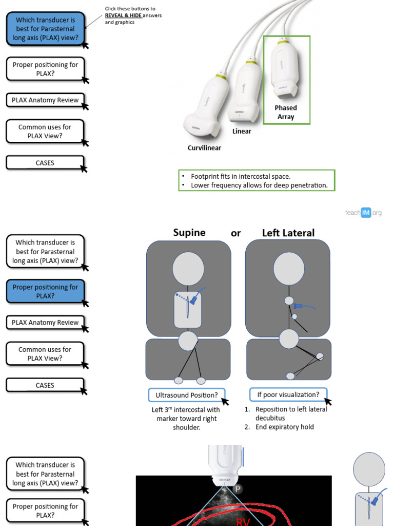 POCUS PSLA Presentation Board 1 | PDF | Heart Valve | Cardiovascular System