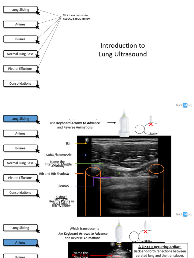 POCUS Lung Workshop No Cases | PDF | Lung | Thorax (Human Anatomy)