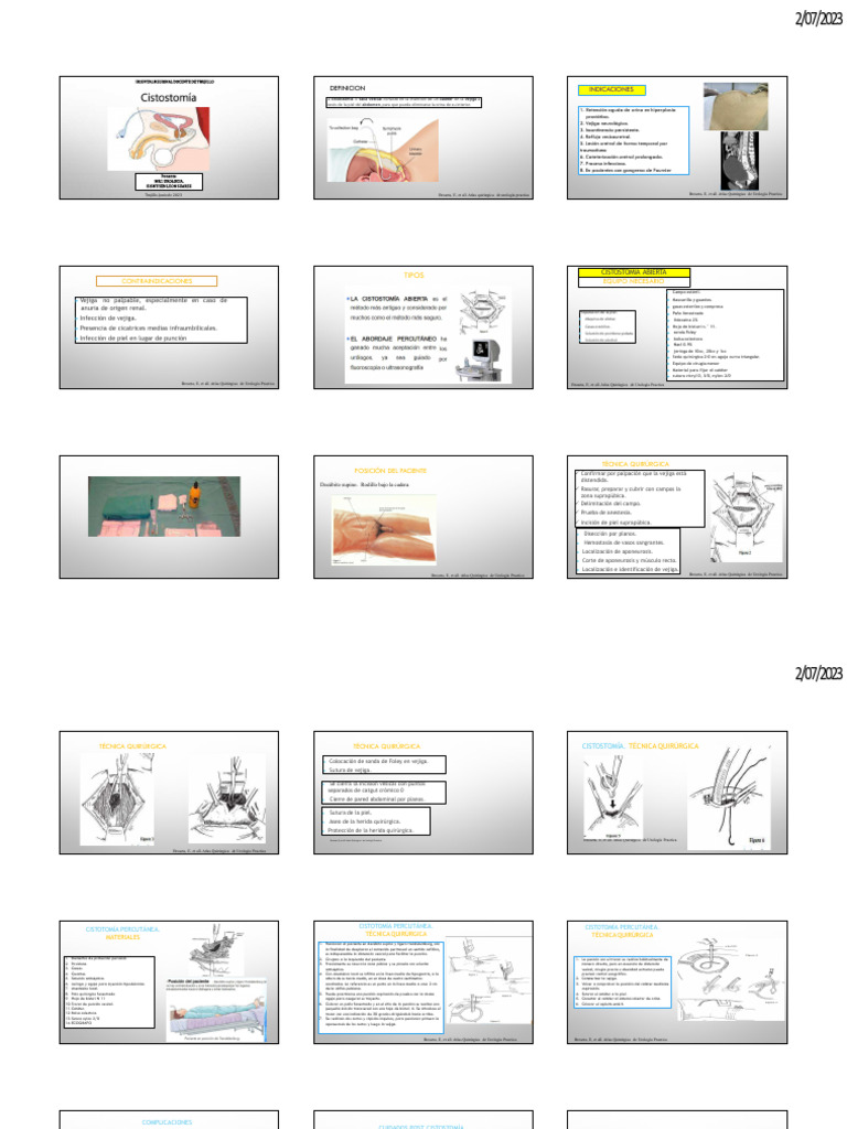 Expocion 02 CX General | PDF | Cirugía | Urología