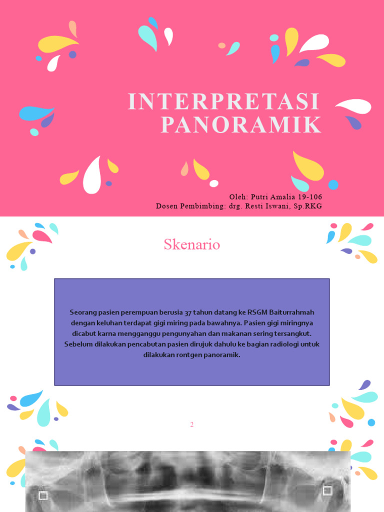 Nadilla Chaniago | PDF