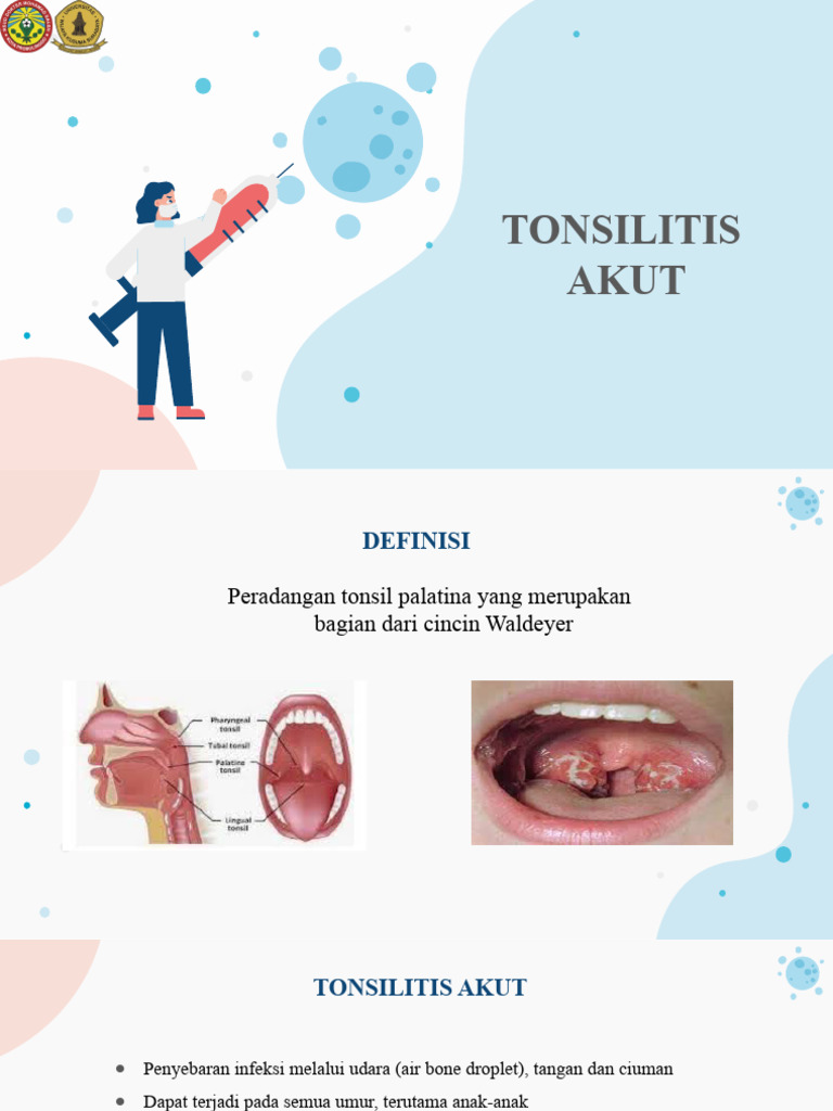 Tonsilitis Akut, Tonsilitis Kronis, Faringitis Akut, Faringitis Kronis, KNF, Anj | PDF