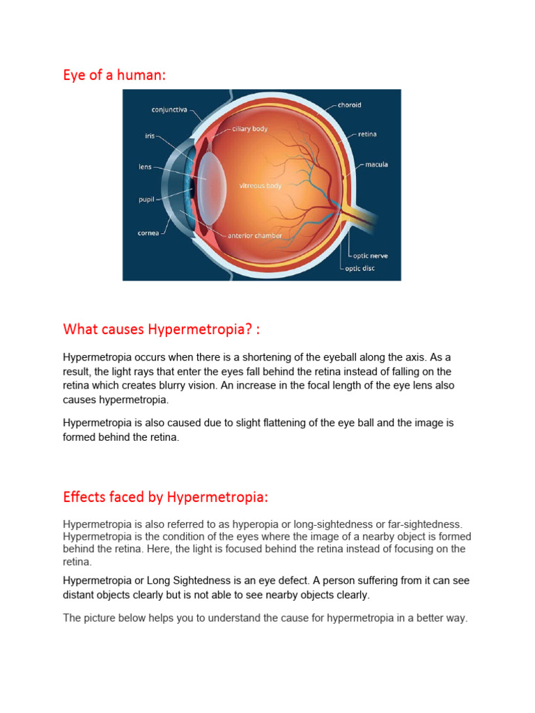 Hypermetropia | PDF | Self-Improvement
