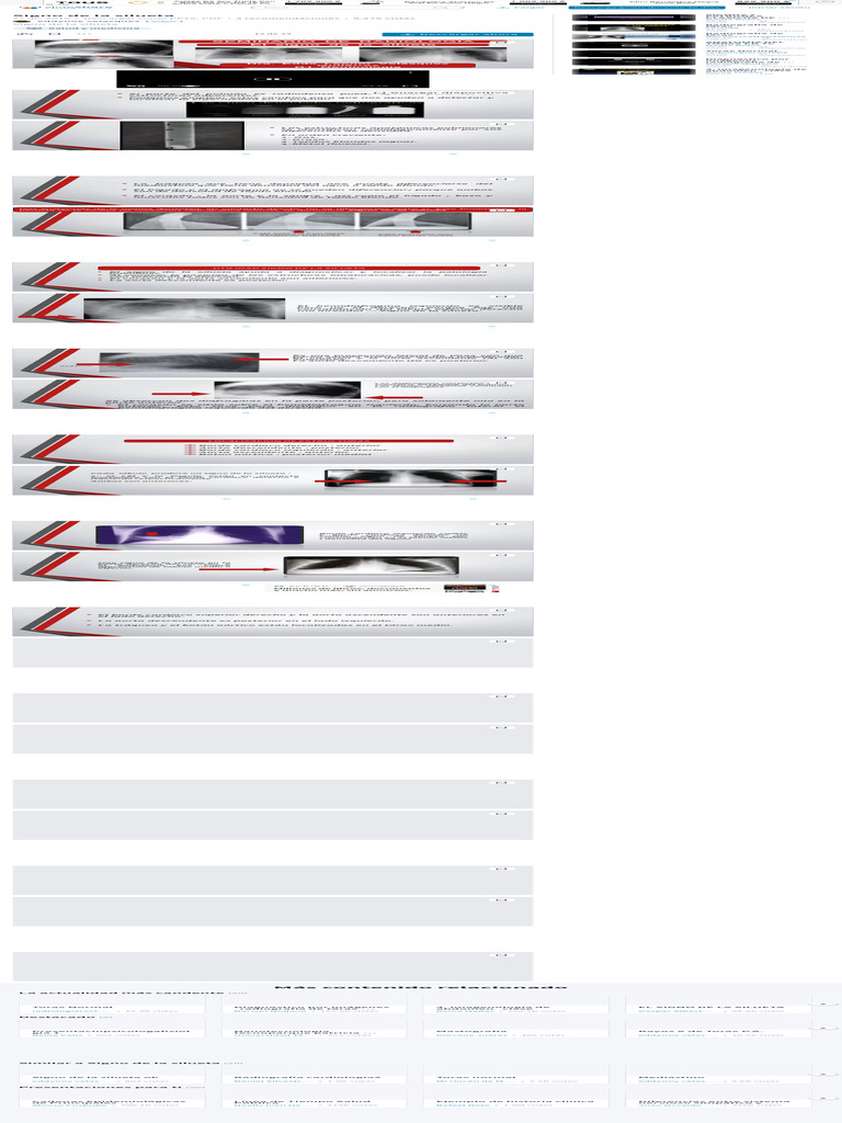 Signo de La Silueta PPT 222 | PDF | Aorta | Corazón