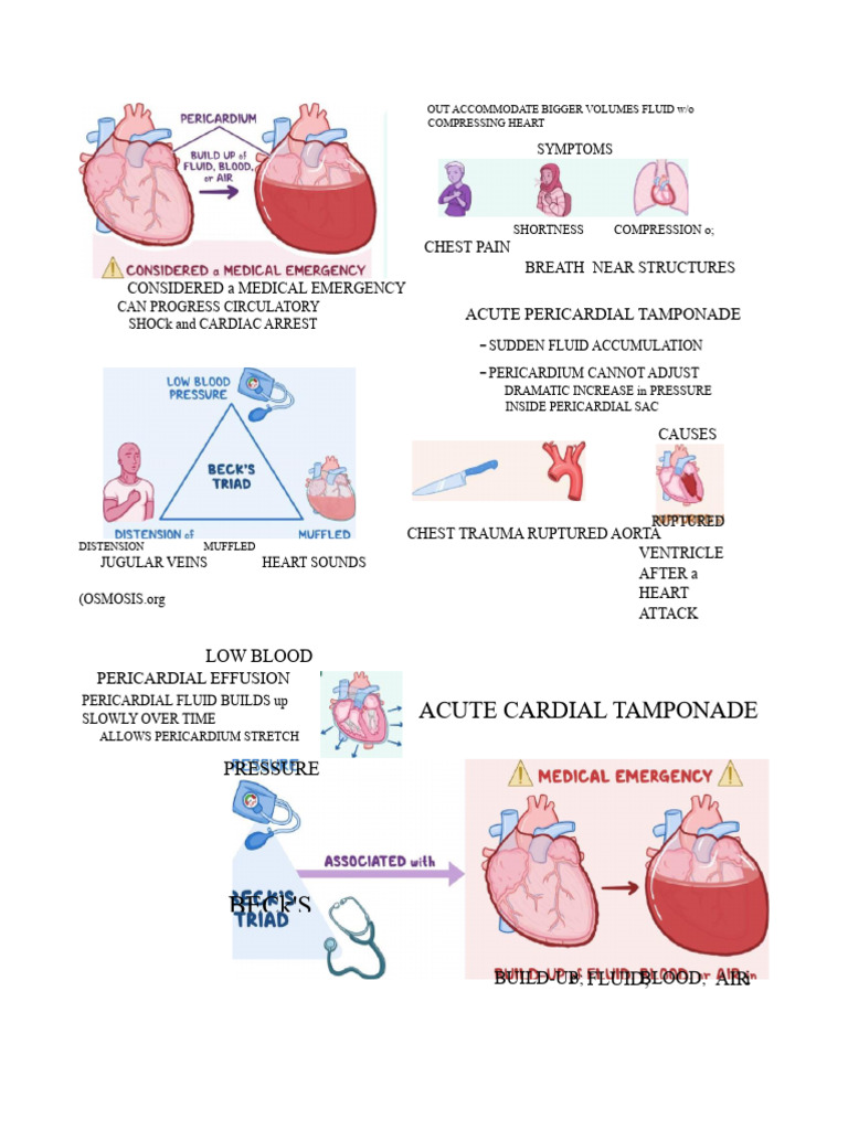 Cardiac Tamponade: Key Symptoms | PDF