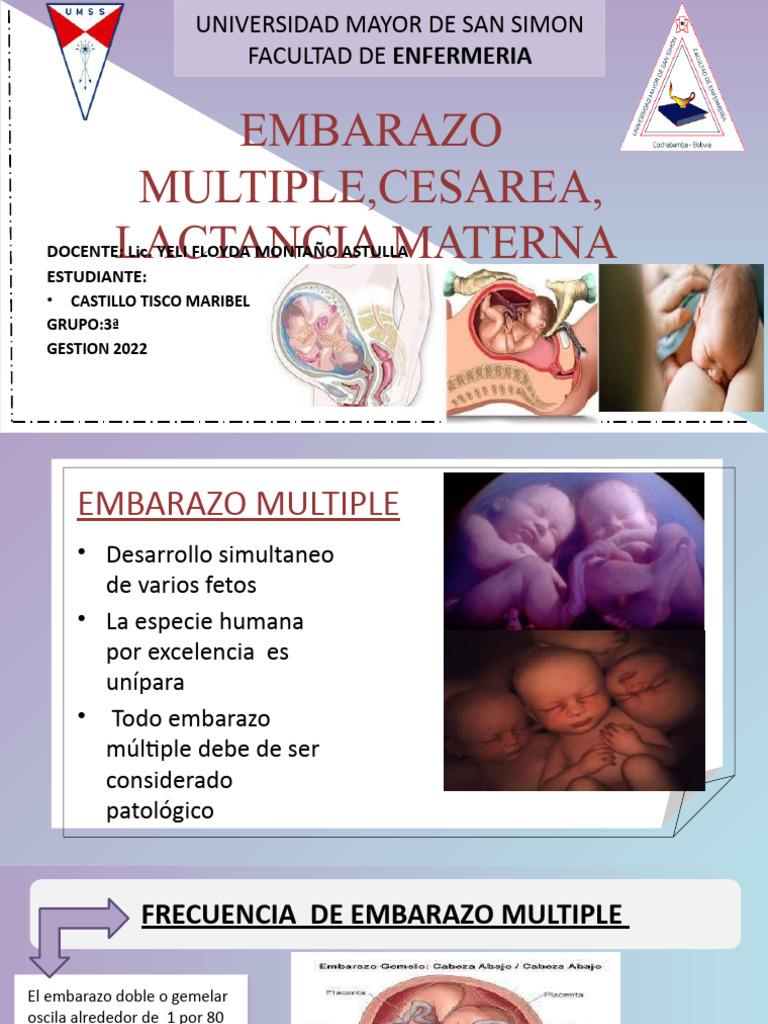 Embarazo Multiple y Cesarea | PDF | El embarazo | Gemelo