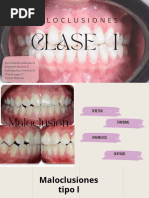 6-4 Grupo 1 Clasificación de Dewey y Anderson | PDF | Anatomia dental ...