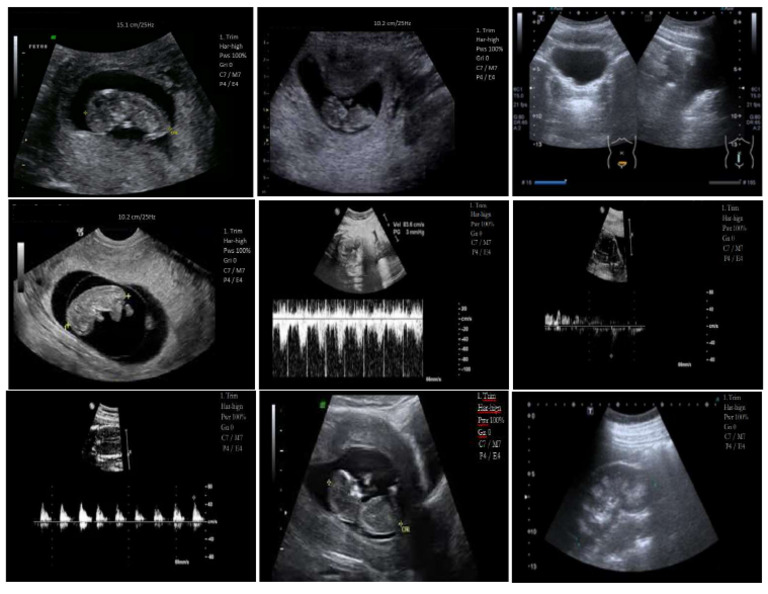 Ultrasonido Ecografia | PDF