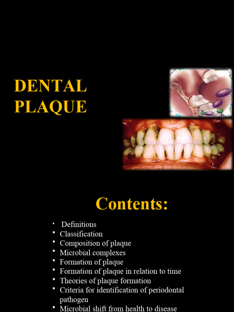 Dental Plaque | PDF | Periodontology | Biofilm