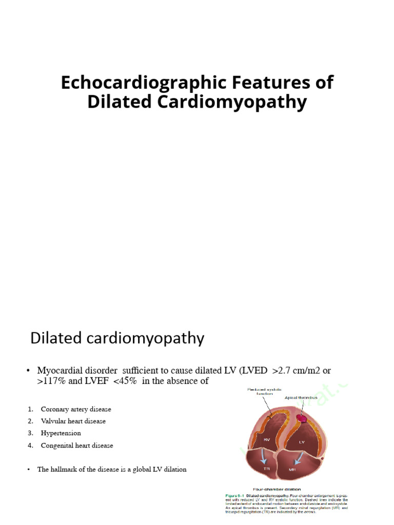 Echocardiography in Dilated Cardiomyopathy | PDF | Ventricle (Heart ...