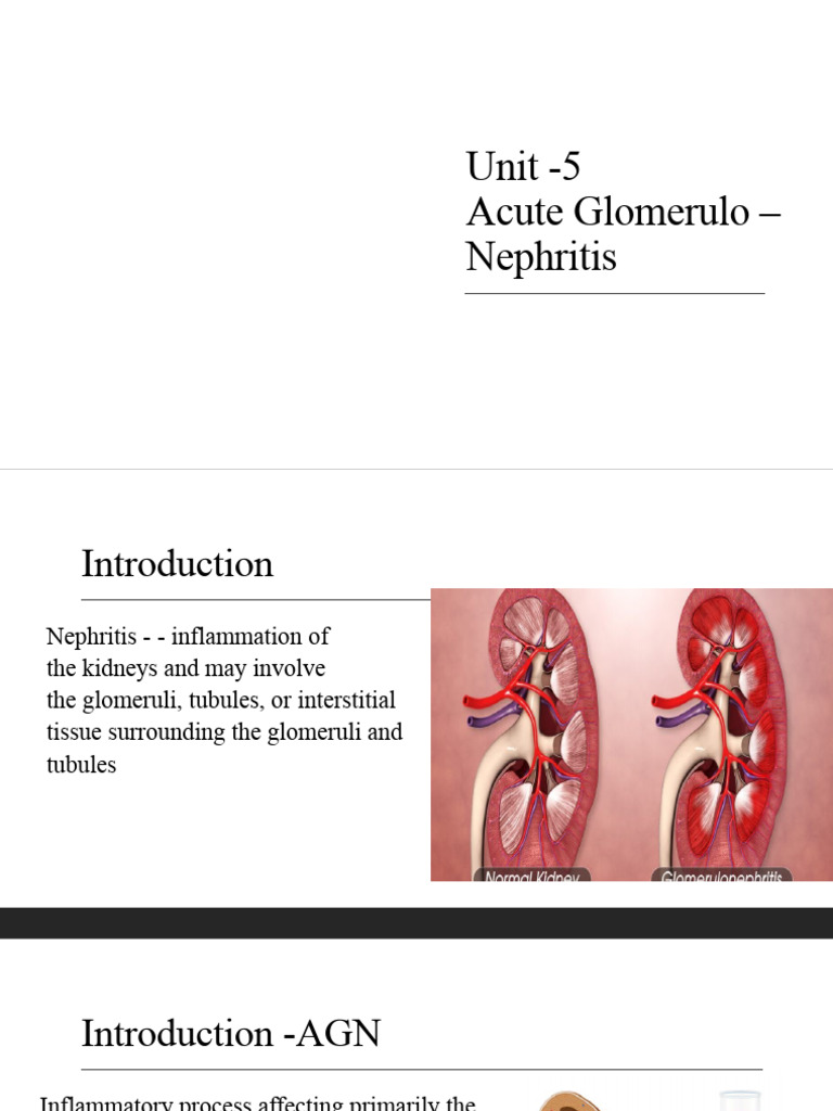 Acute Glomerulonephritis in Children | PDF | Kidney Disease | Medical ...