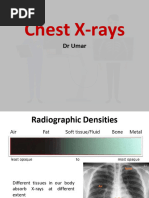 Chest Xray Report | PDF | Radiology | Thorax