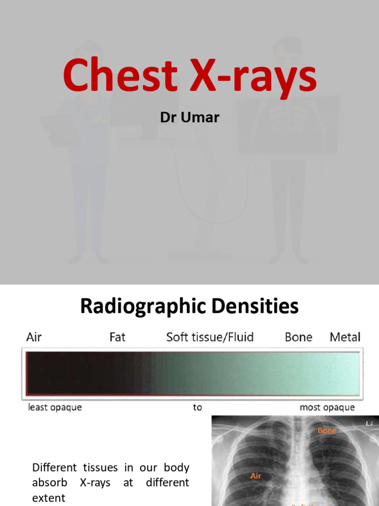 Chest Xray | PDF | Heart | Lung