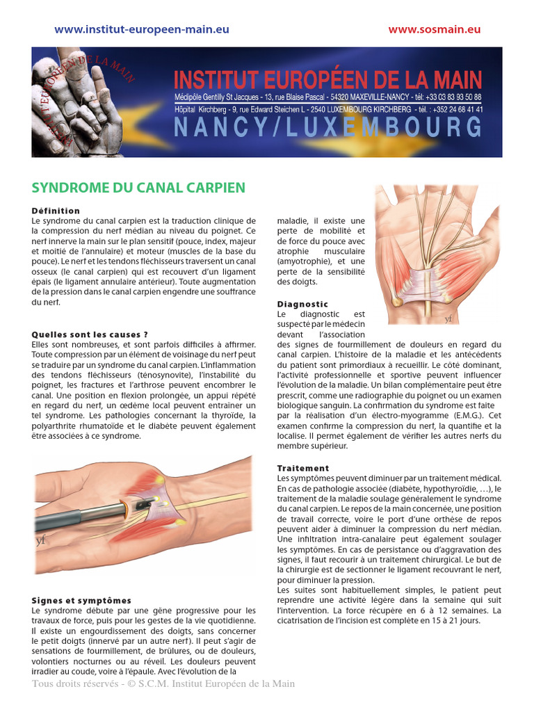 Comprendre le syndrome du canal carpien | PDF | Syndrome du canal ...