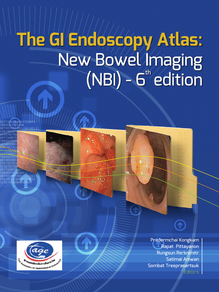 Atlas de Endos Casos Clin Gi 6a Ed | PDF | Gastroesophageal Reflux Disease | Esophageal Cancer