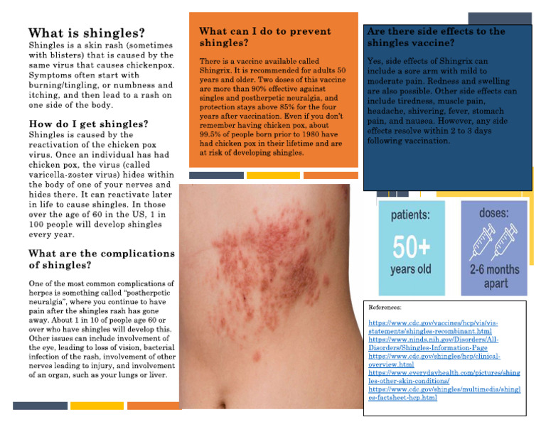 Shingles Sheet Version 2 | PDF