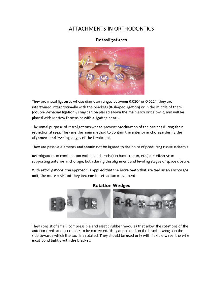 Attachments Used in Orthodontics First Semester | PDF | Orthodontics ...