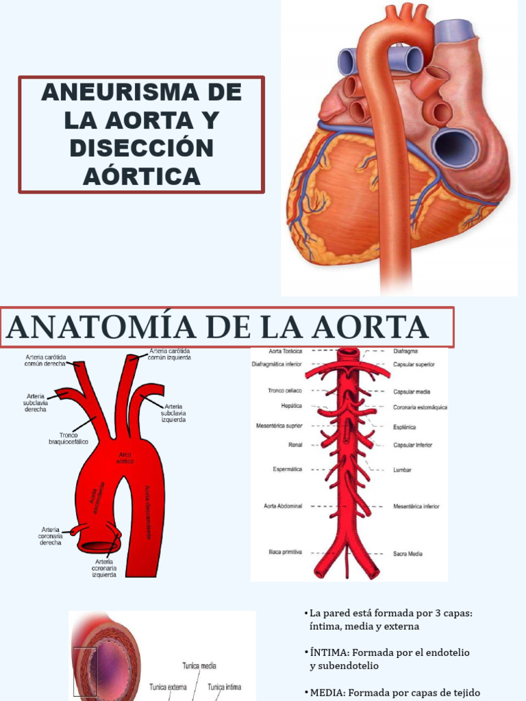 ANEURISMA DE LA AORTA Y DISECCIÓN AÓRTICA | PDF | Aorta | Medicina CLINICA