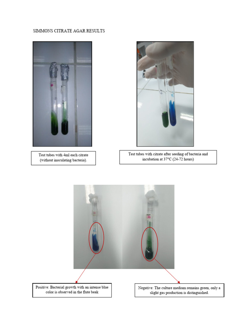 Simmons Citrate Agar Results | PDF | Growth Medium | Bacteria