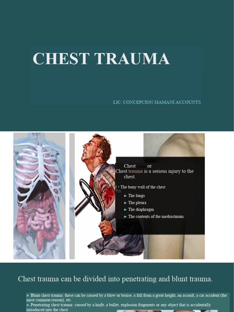 Thoracic Trauma | PDF | Thorax | Major Trauma