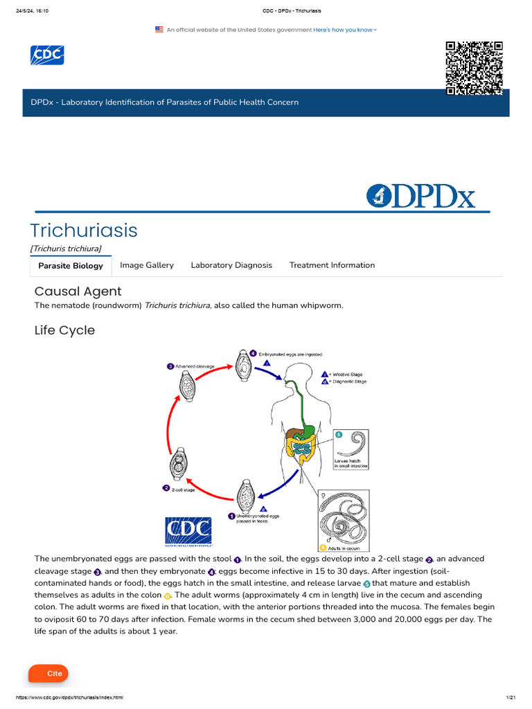 CDC - DPDX - Trichuriasis | PDF | Medical Specialties | Diseases And Disorders