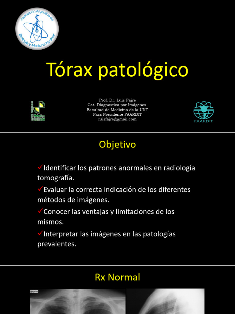 Torax Patologico Curso Radioterapia | PDF | Pulmón | Neumonía