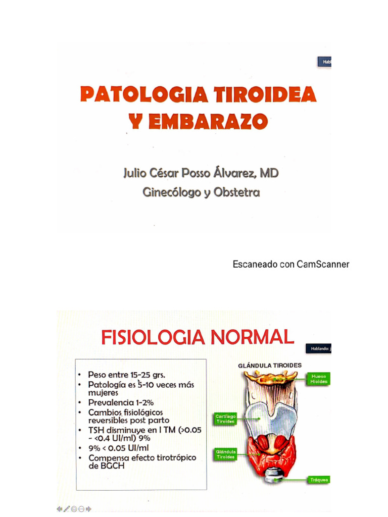 Patología Tiroidea | PDF