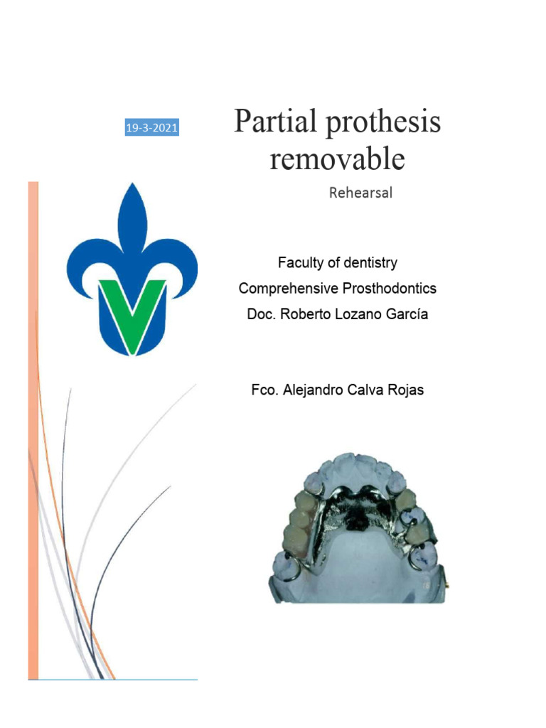 Removable Partial Denture Overview | PDF | Prosthesis | Dentistry