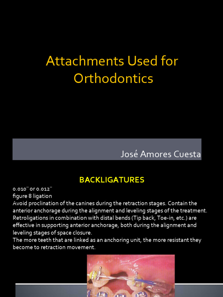 Attachments Used For Orthodontics | PDF | Orthodontics | Dentistry Branches