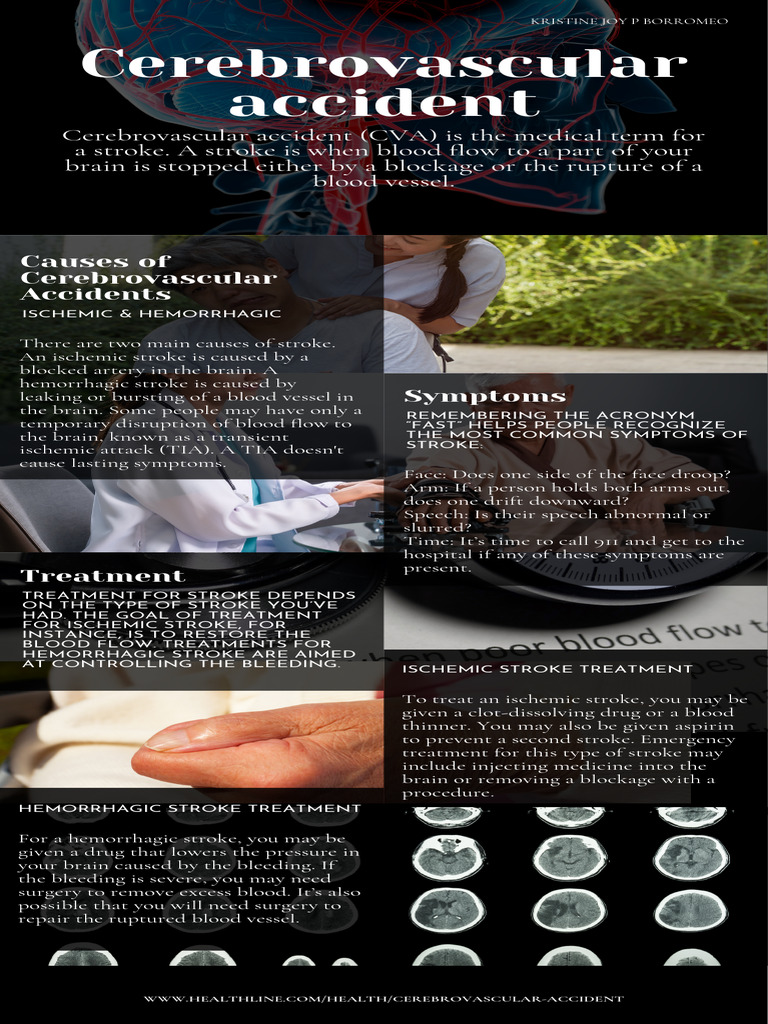 Understanding Stroke Types and Treatments | PDF | Stroke | Neurological ...