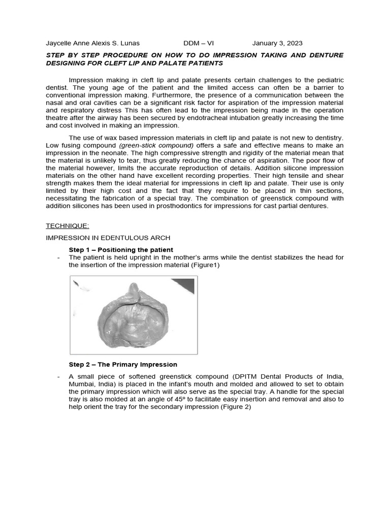 Alexis Step by Step Impression Taking Cleft Lip Palate | PDF | Dentures ...