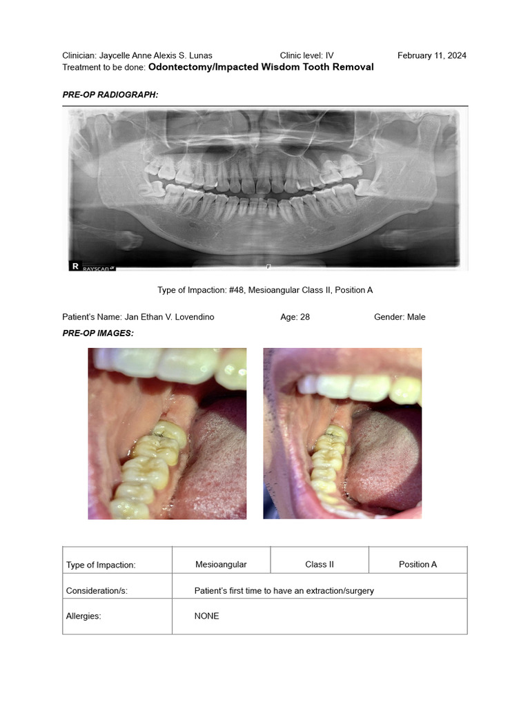 TX Plan Odontectomy Alexis | Download Free PDF | Surgery | Clinical ...