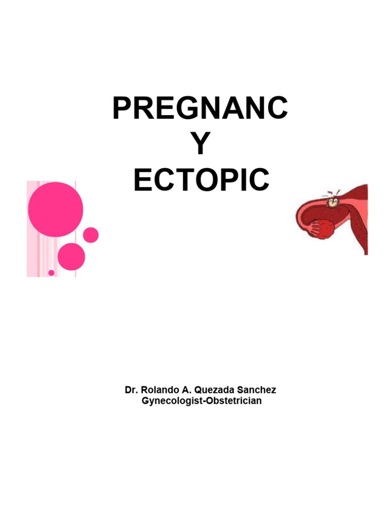 Ectopic Pregnancy | PDF | Miscarriage | Pregnancy